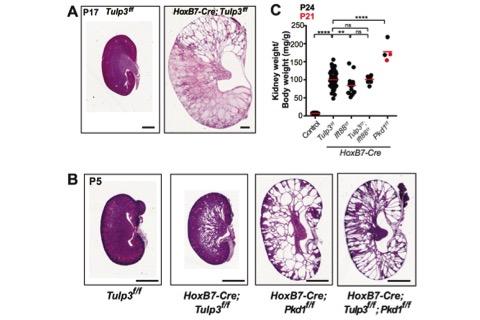 Trafficking into Cilia in PKD | Mukhopadhyay Lab | UT Southwestern, Dallas, Texas